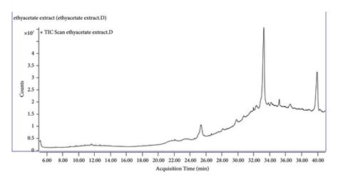 The Gc Ms Chromatogram Was Obtained From The Ethyl Acetate Extract From