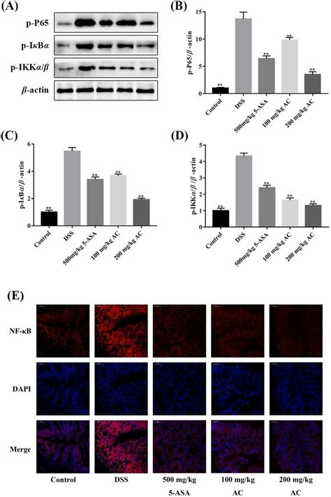Effect Of Ac On The Protein Expression Of P P65 Iκbα And Ikkαβ A Download Scientific Diagram