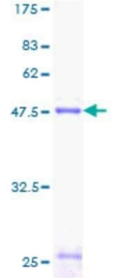 Novus Biologicals™ Recombinant Human Prosurfactant Protein C Gst N