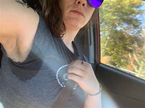 I Got Underarm Botox Today R Hyperhidrosis