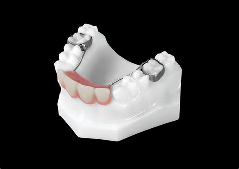 Pedo Partial Universal Orthodontic Lab