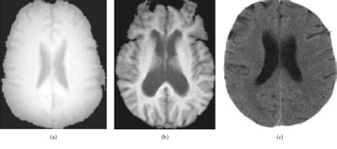 Figure 1 From Medical Image Classification Algorithm Based On Weight