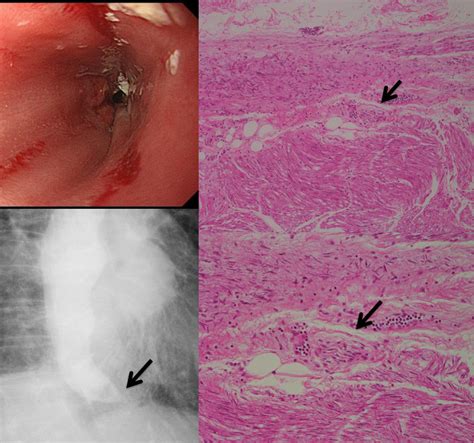 Gastrointestinal Fiberscopy A And Upper Gastrointestinal Fluoroscopy