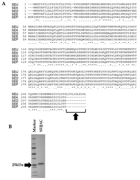 Development Of An Immunoassay For Detection Of Staphylococcal Enterotoxin Like J A Non