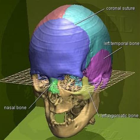 Hackaday Prize Entry A 100 Ct Scanner Hackaday
