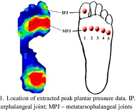 Figure 1 From Automated Classification Of Plantar Pressure Asymmetry During Pathological Gait