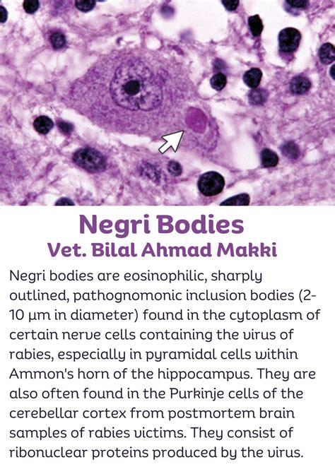 Bilal Ahmad Makki On Linkedin Negri Bodies Typically Refers To