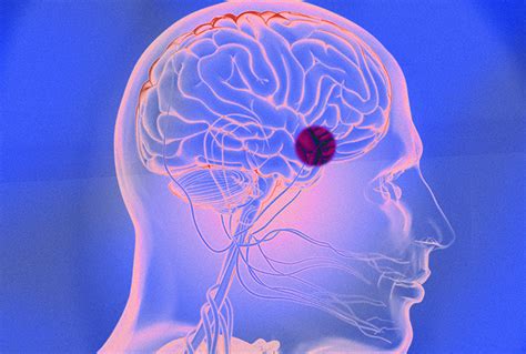 The Sexual Effects Of High Prolactin Levels In Men