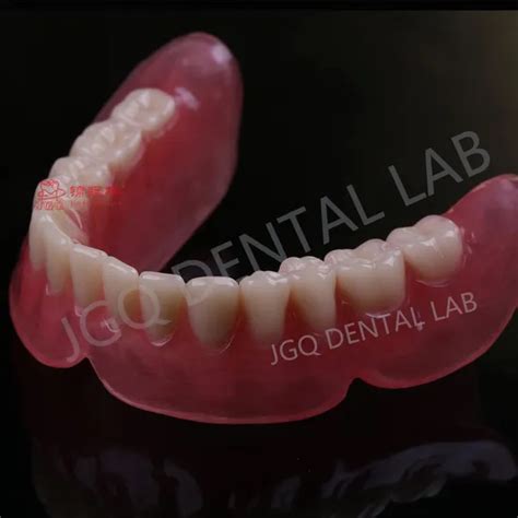 Removable Partial Denture Or Bridge Natural Looking Appliance Comfort
