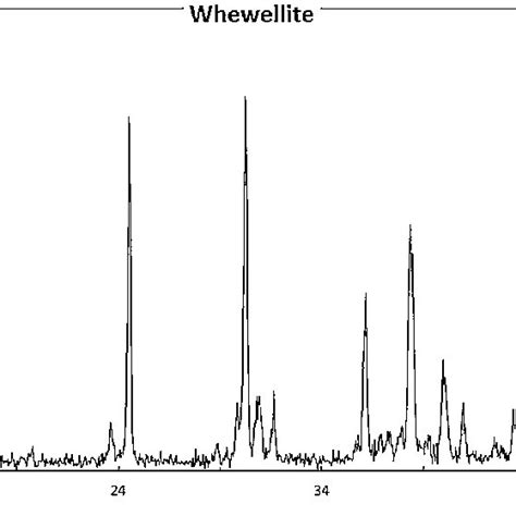 X Ray Diffraction Pattern Of Calcium Oxalate Stone Sample Mp 2