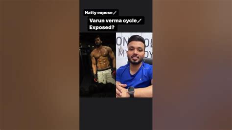 Varun Verma Exposed💉 Youtube