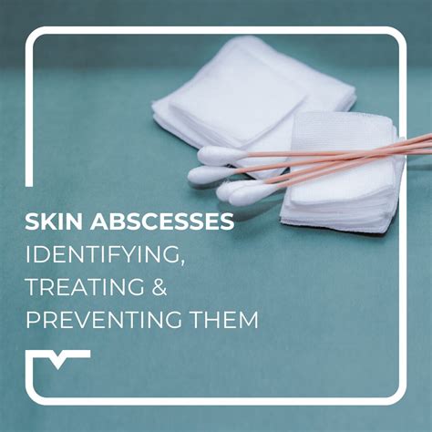 Skin Abscess Identifying Treating And Preventing Them Alegria Medical Centre