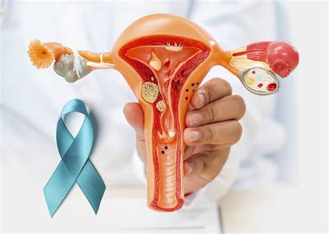 „Пълмед“ с безплатни прегледи за профилактика на рака на маточната шийка