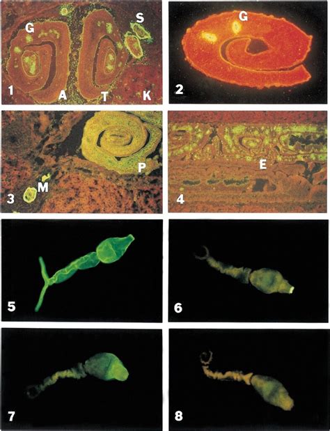 Immunofluorescence Patterns With Different Mabs 1 3 And 4 Frozen