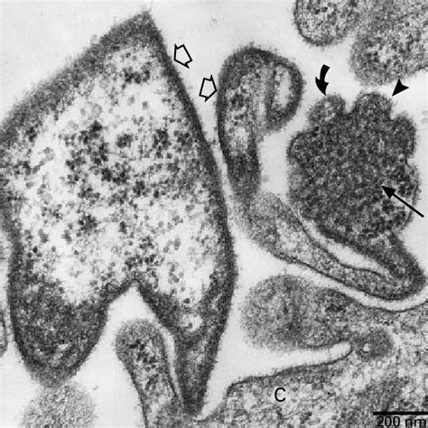 Pdf Clinical Features Of Nipah Virus Encephalitis Among Pig Farmers