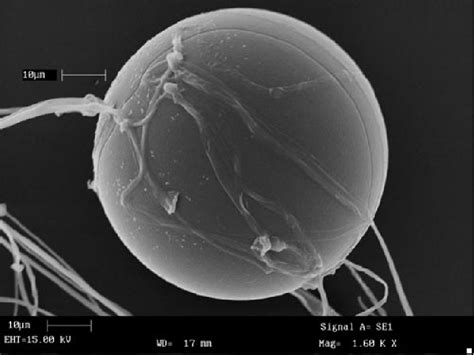 Single Spore Cyst SEM X 1600 Download Scientific Diagram