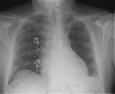 Image Processing Radiology Suny Upstate