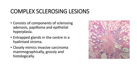 Normal And Malignant Cytology Of Breast Cytology Pptx