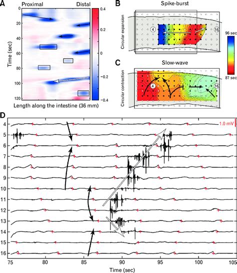 slow wave and spike burst activity during spontaneous peristaltic
