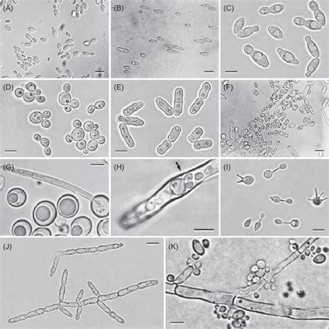 1 Various Forms Of Asexual Reproduction A Polar Budding On A Narrow