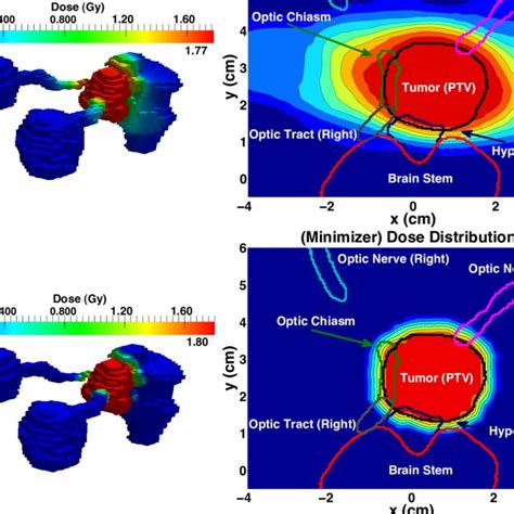 A Comparison Of The Applied Dose Distribution Top And The Minimizer Download Scientific