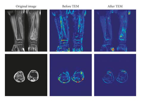 visualization of feature maps before and after tem download