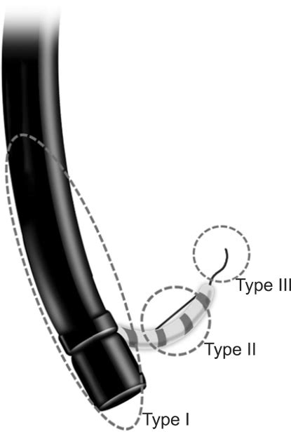 Classification Of Endoscopic Retrograde Download Scientific Diagram