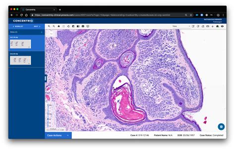 Ai Powered Digital Pathology Solution Scientist Live