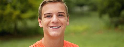 Ceramic Braces Vs Invisalign Birmingham Orthodontics