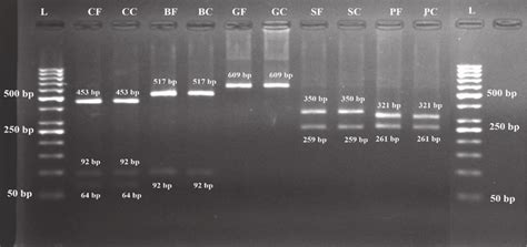 Alui Digestion Pattern Of 609 Bp Fragment Of Cyt B Gene Of Cattle