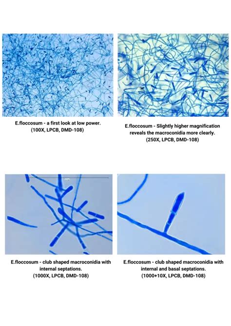 Epidermophyton Floccosum Biology Notes Online