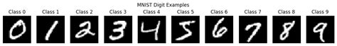 5 📊 Mnist Image Classification — Surgical Phase Recognition Project V11 Documentation
