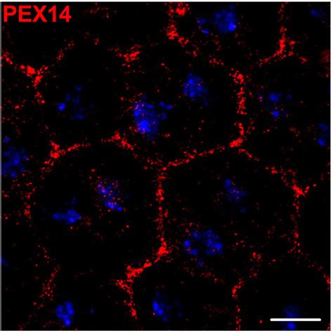 Localization Of Peroxisomes In The Murine Rpe Double Staining For Download Scientific Diagram