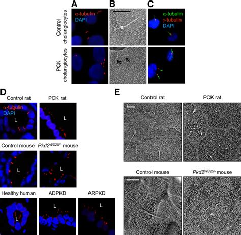 Cystic Cholangiocytes Are Multiciliated A And B Numbers Of Cilia Per