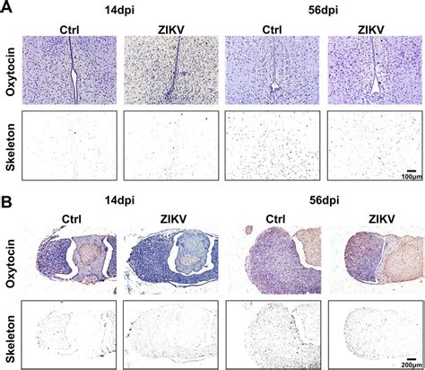 Effects Of Zikv Infection On Oxytocin Production A Download
