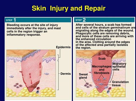 What Causes Skin Indentations At Roscoe Ramirez Blog