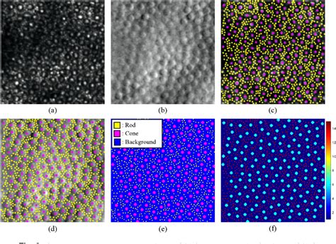 Figure 1 From Rac Cnn Multimodal Deep Learning Based Automatic