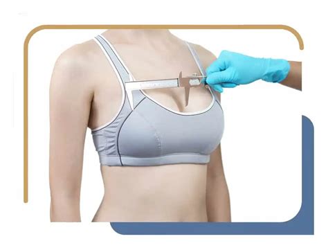 Schnur Scale For Breast Reduction Harris Plastic Surgery