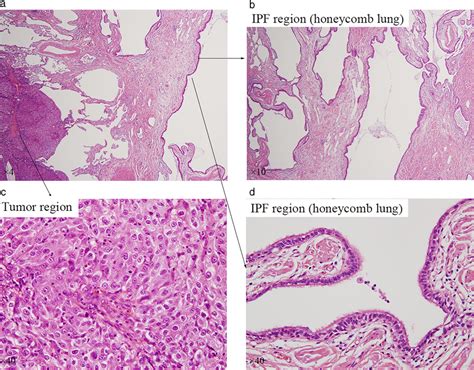 Hematoxylin And Eosin Staining Showing The Histopathological Findings Download Scientific