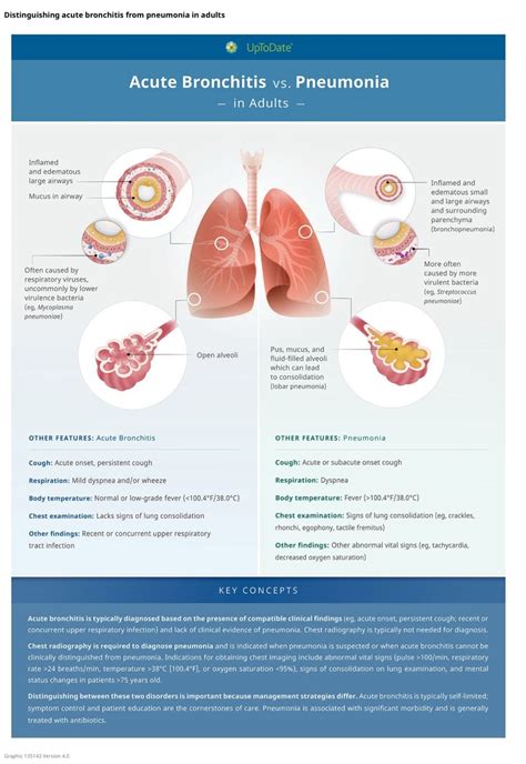 Acute Bronchitis Vs Pneumonia Dr Kamran Ahmed Mbbs
