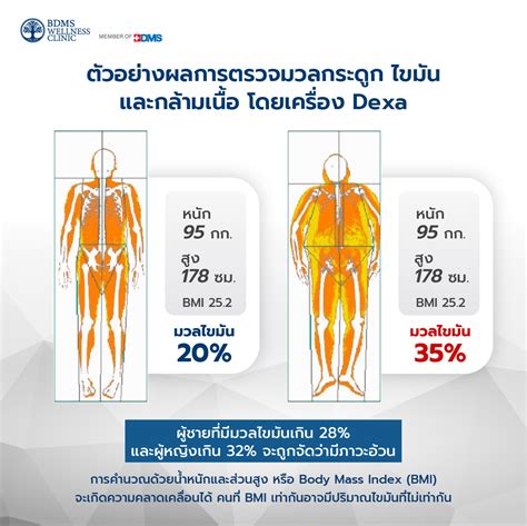 เพราะความอ้วนหรือผอม ดูเพียงภายนอกไม่ได้ สุขภาพน่ารู้ Bdms Wellness