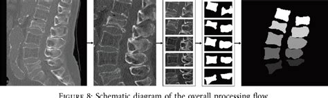 Figure 1 From A Spine Segmentation Method Under An Arbitrary Field Of