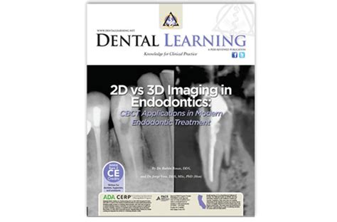 2d Vs 3d Imaging In Endodontics Cbct Application In Modern Endodontic