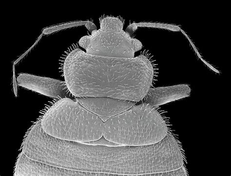 Bed Bug Photograph By Dennis Kunkel Microscopy Science Photo Library Fine Art America