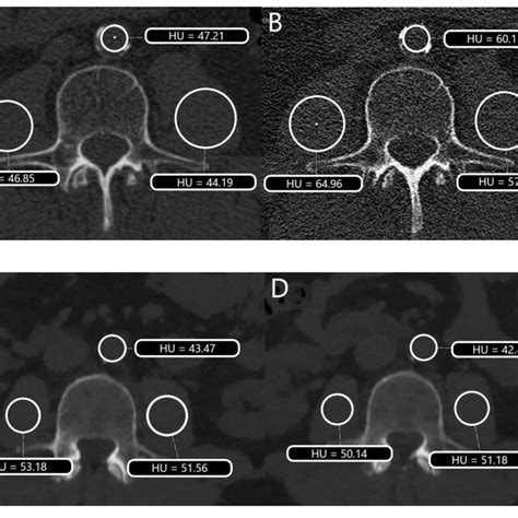 Bone Morphogenetic Protein 2 Expression Between Experimental Groups At
