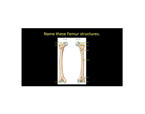 Name These Femur Structures Quiz