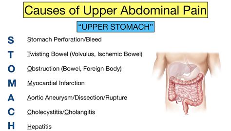 Abdominal Pain Causes By Location Stomach Anatomy And 45 Off