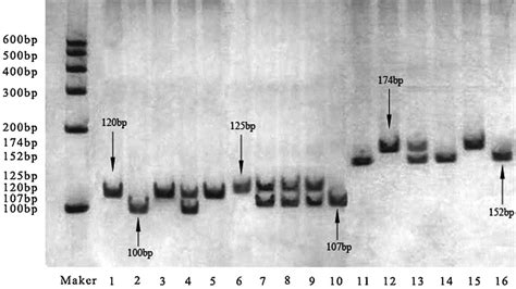 Pcr Rflp Analysis Of Runx3 Gene Polymorphisms Rs2236852 Locus 1 3