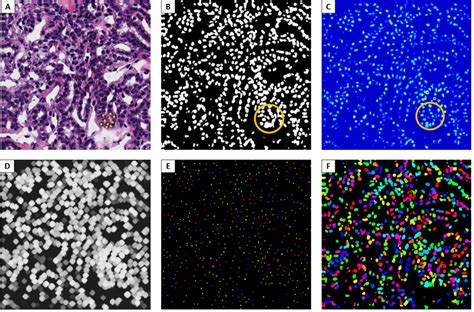 Ndg Cam Detection Workflow A Zone With Multiple Neighboring Download Scientific Diagram