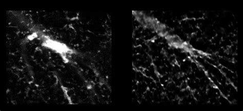 Restoration Of The Raw 3d Image Using Deconvolution With The Predicted